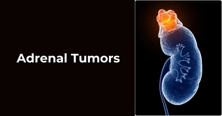 Adrenal Tumors - Pi Health Cancer Hospital