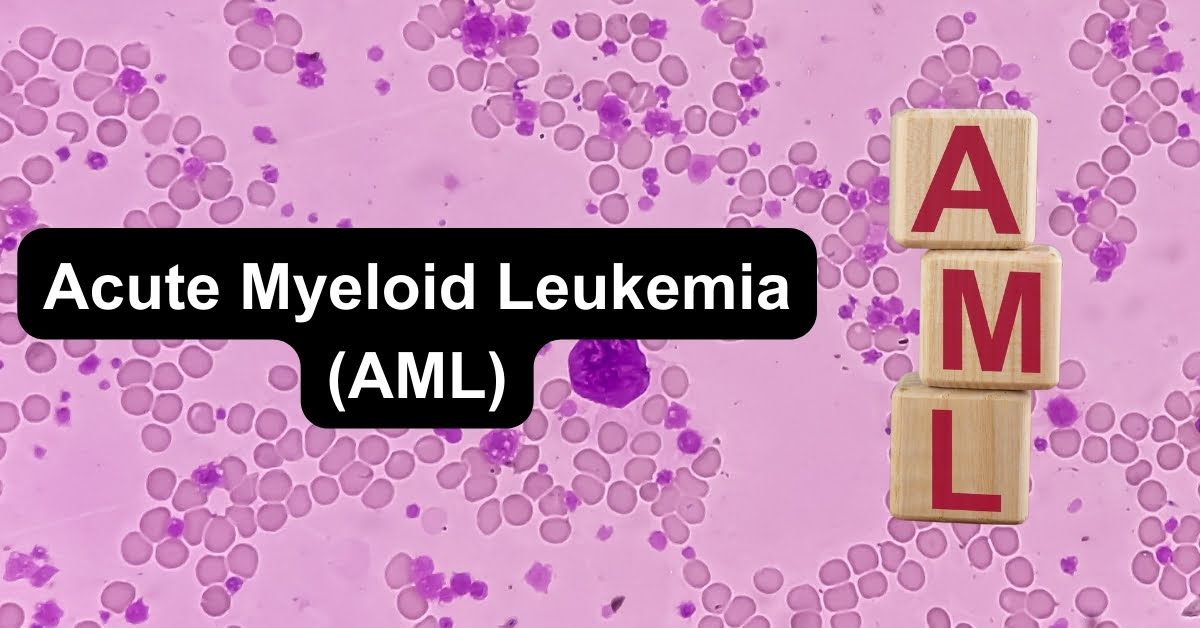 Acute Myeloid Leukemia (AML) - Pi Health Cancer Hospital