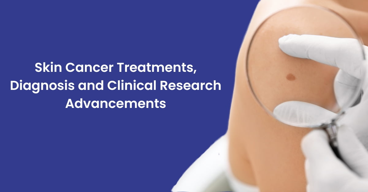Skin Cancer Treatments , Diagnosis and Clinical Research Advancements ...