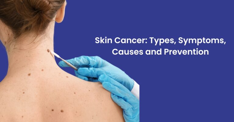 Skin Cancer Types Symptoms Causes And Prevention Pi Health Cancer Hospital