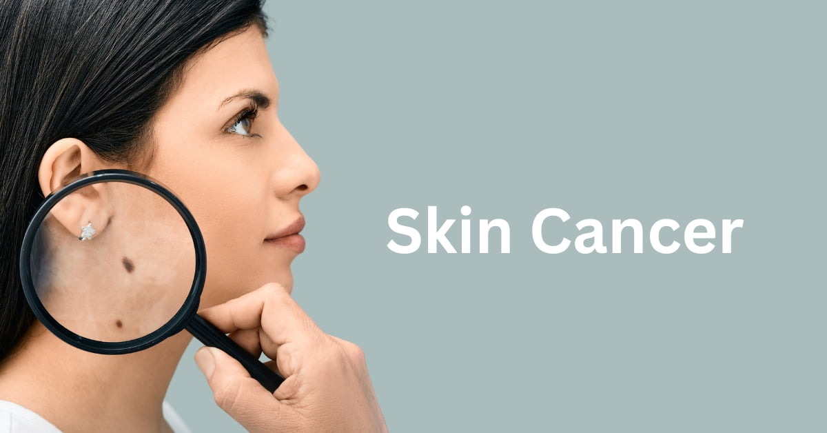 How to Prevent Skin Cancer? - Pi Health Cancer Hospital