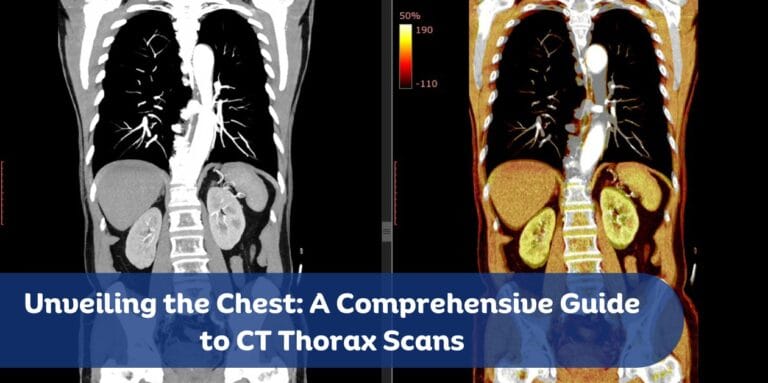 Unveiling the Chest: A Comprehensive Guide to CT Thorax Scans - Pi ...