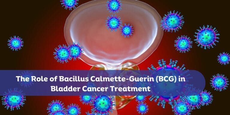 The Role of Bacillus Calmette-Guerin (BCG) in Bladder Cancer Treatment ...