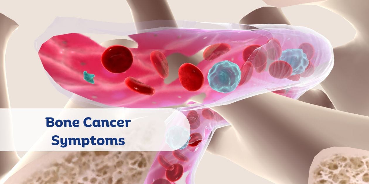 Bone Cancer Symptoms - Pi Health Cancer Hospital