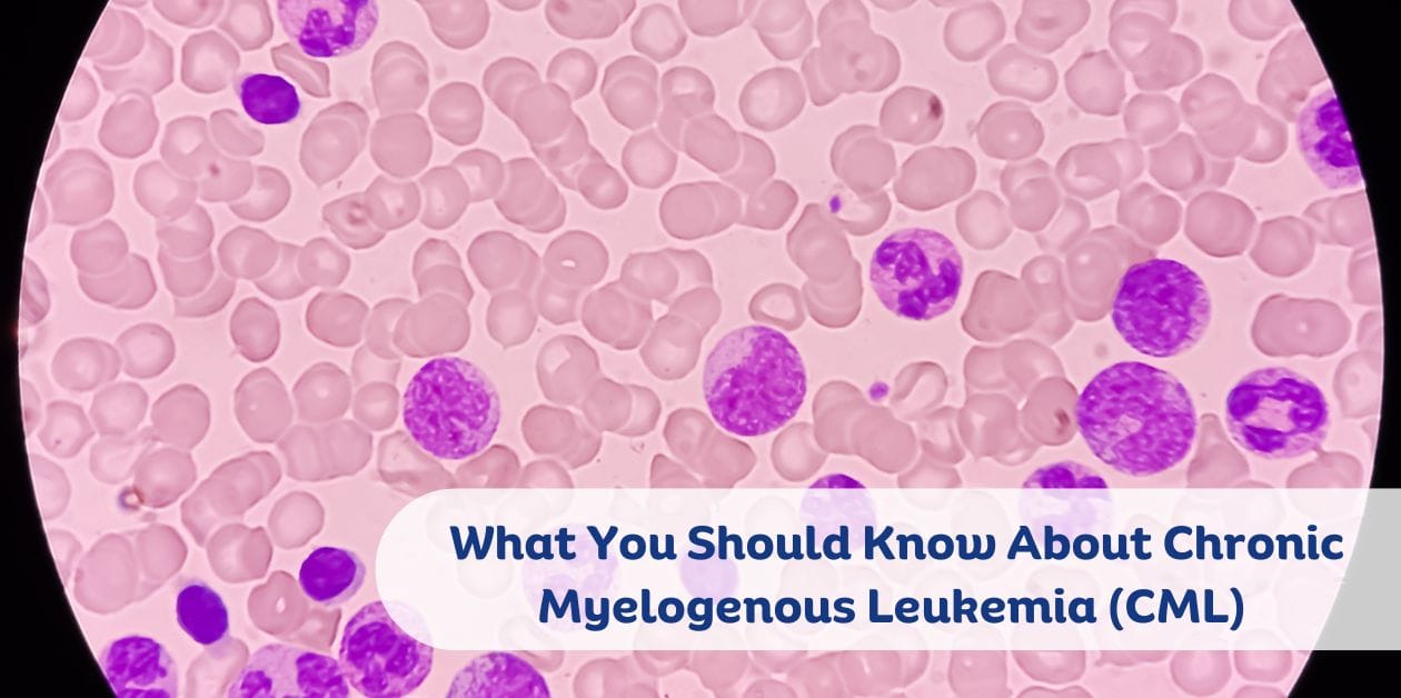 What You Should Know About Chronic Myelogenous Leukemia (CML) - Pi ...