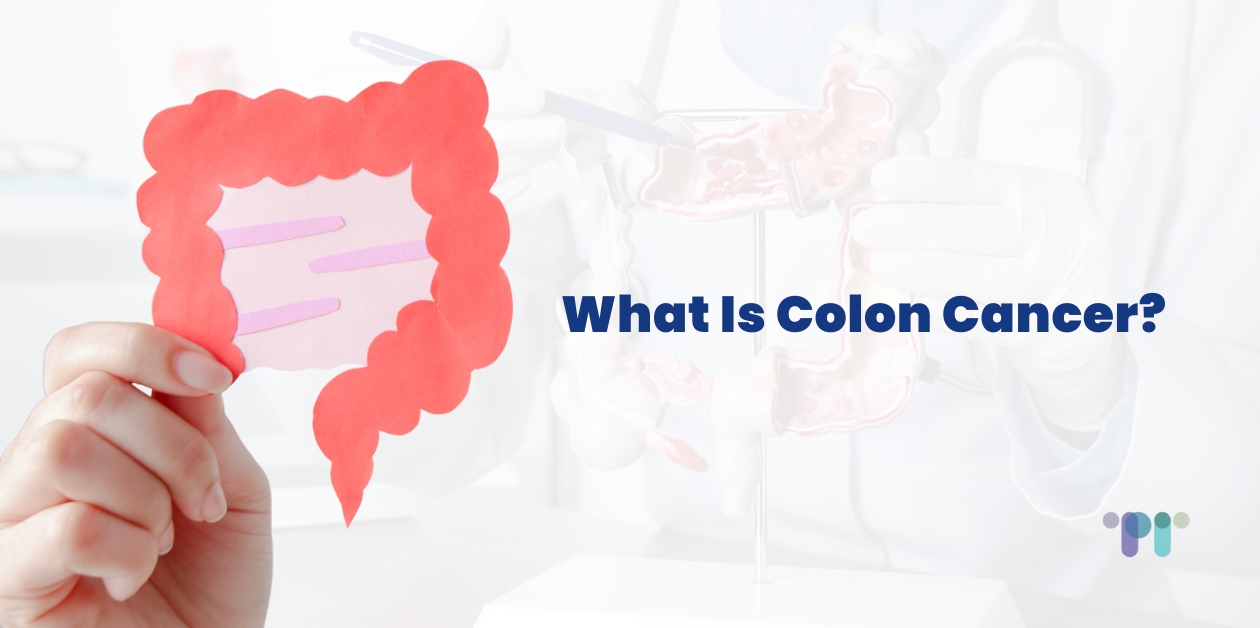 Colon Cancer: Early Signs & Prevention
